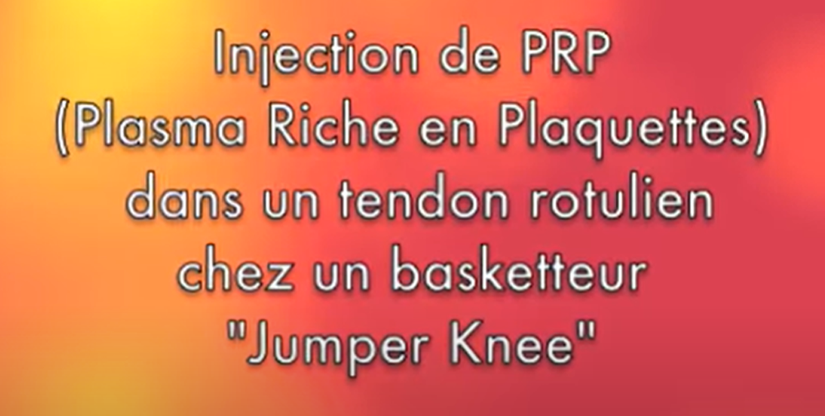 Injection PRP tendon rotulien sous echo - Par le Docteur Christophe ...