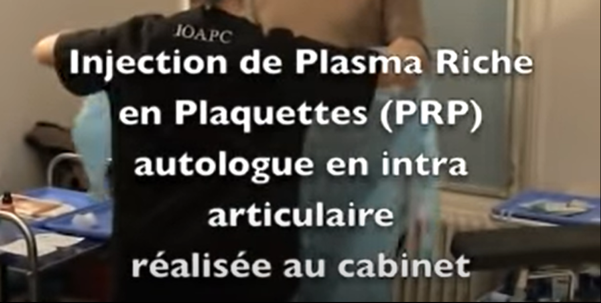 injection PRP en intra articulaire du genou par le Docteur Christophe ...